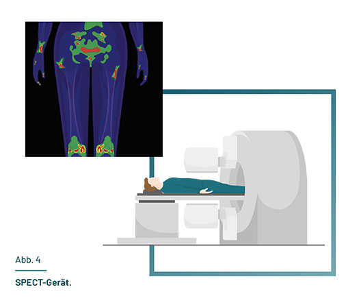 Bildgebung beim metastasierten Prostatakrebs | leben-mit-prostatakrebs.de
